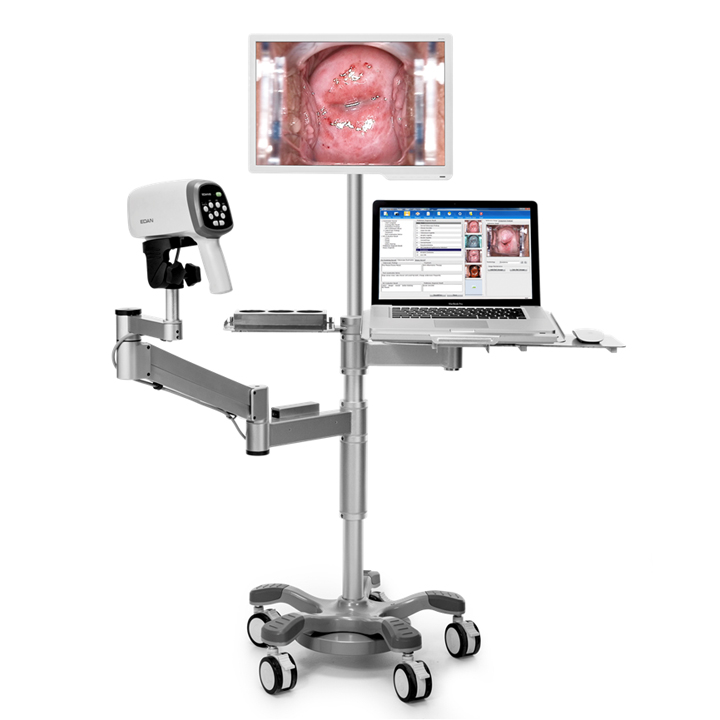 Colposcopy | Asian Med